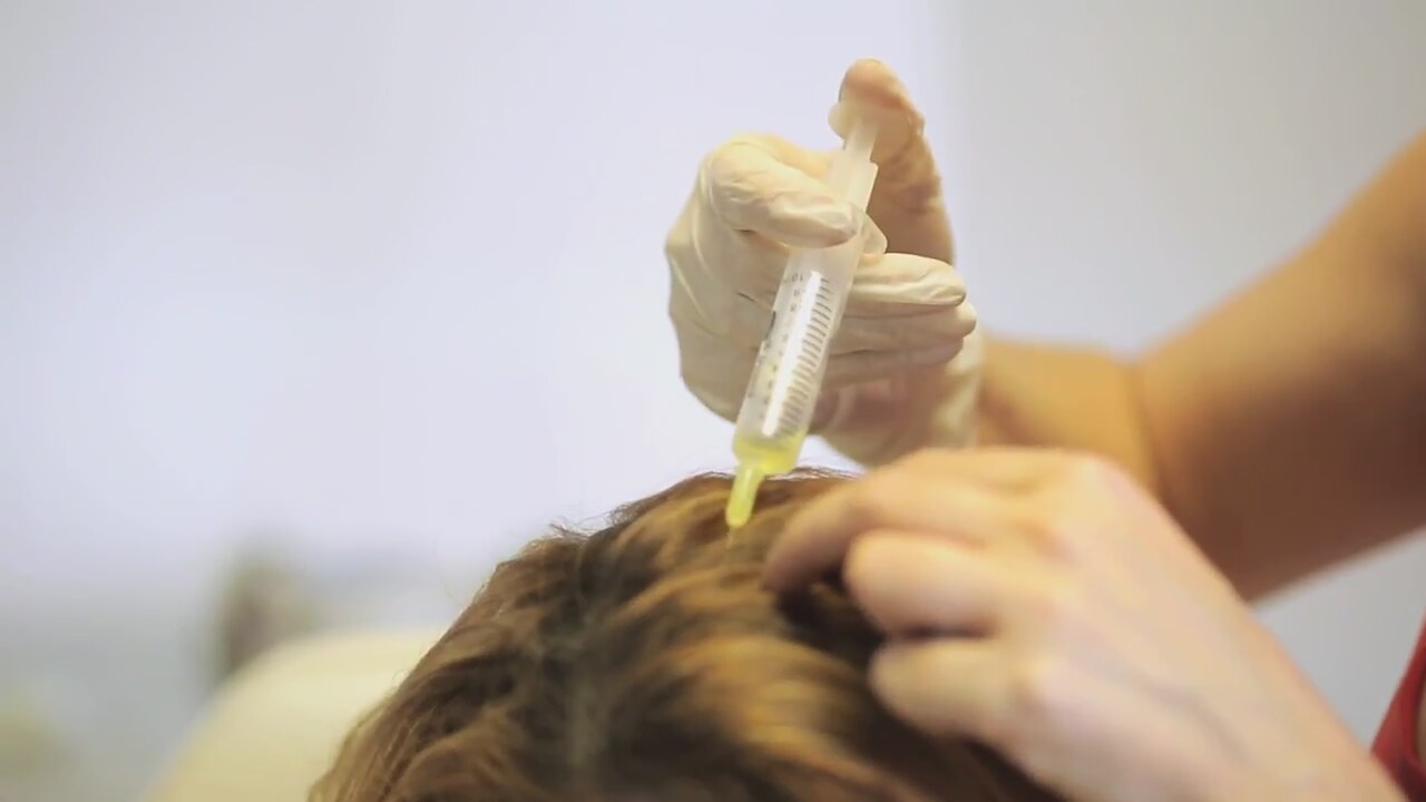 Mesoterapi - Hud & Hår | PRP Behandling • Medictur